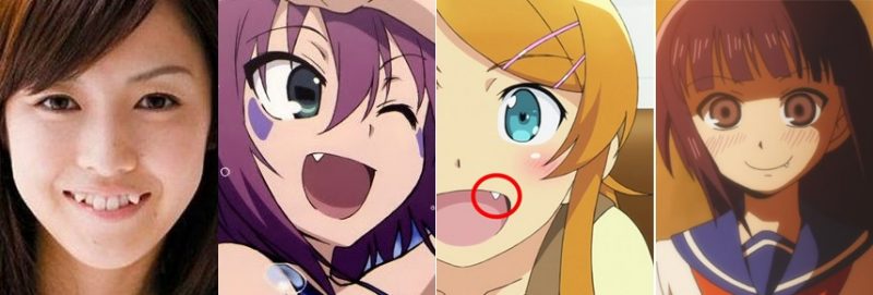 Yaeba: Trend of Crooked Teeth in Japan